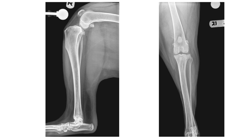 Complete Guide to Tibial Plateau Leveling Osteotomy (TPLO) in Dogs - Dr ...